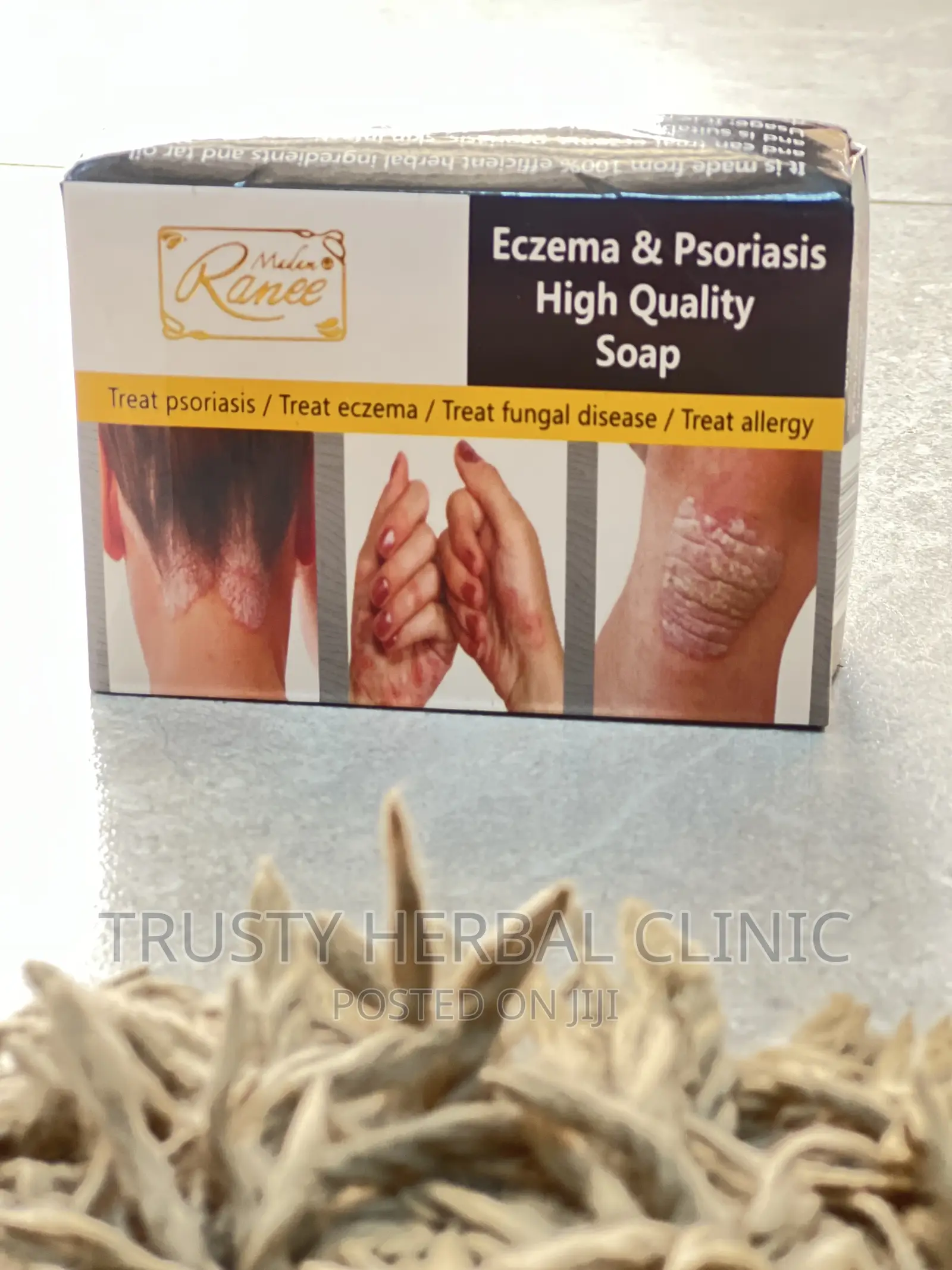 Madam Ranee Eczema Psoriasis Soap for Fungal Disease in Accra ...